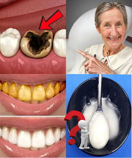 Naturally Reverse Early Tooth Decay: 6 Proven Tips to Strengthen Enamel ...